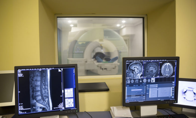 A man died in the US after he was jerked by an MRI device because of ...